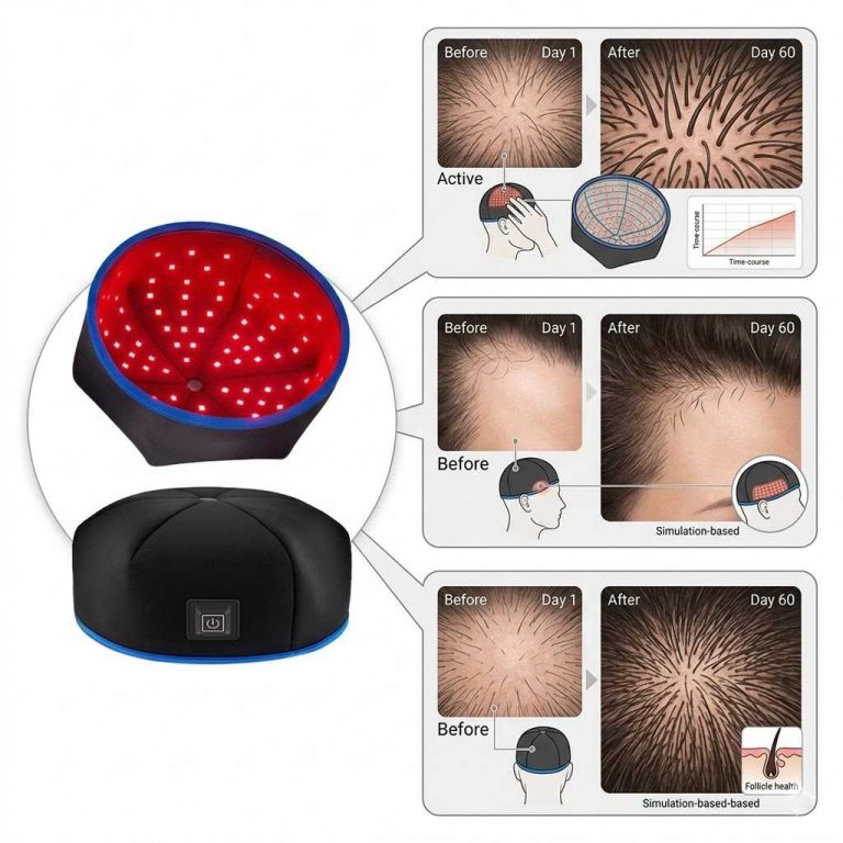 Red Light Hair Growth Cap 2A 10W 660nm 850nm - BBIER®